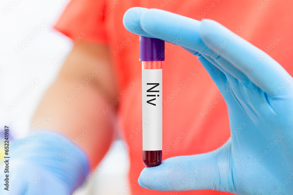 Blood sample tube for Nipah Virus test.Blood sample tube for Nipah ...