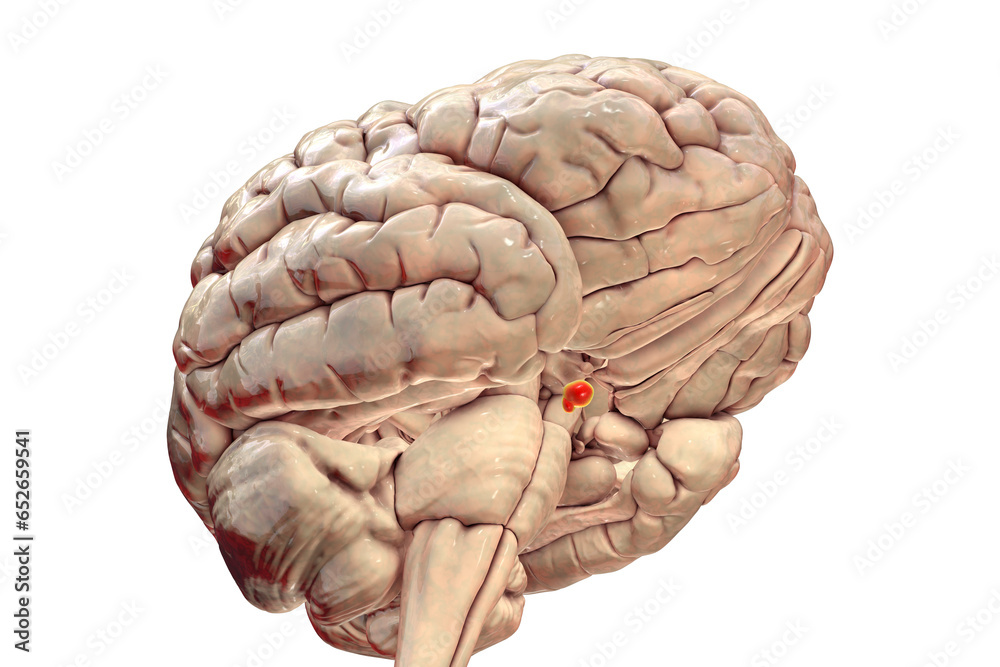 Pituitary gland anatomy in the brain, 3D illustration Stock ...
