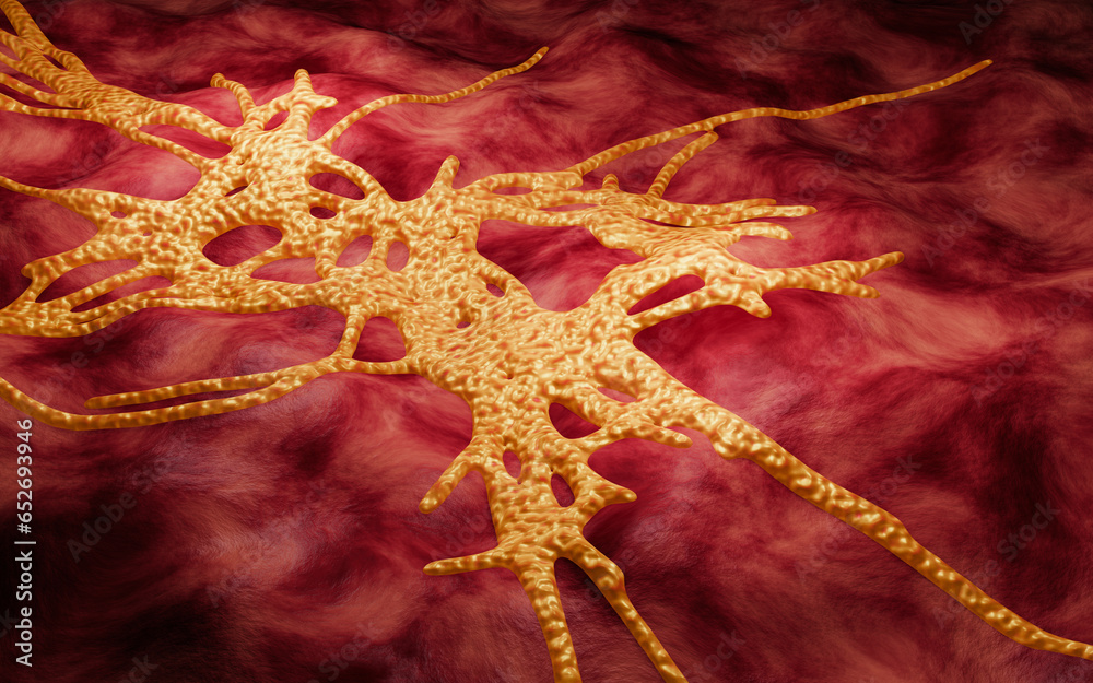 spread of cancer cells On body tissues. Distribute fat deposits in the ...