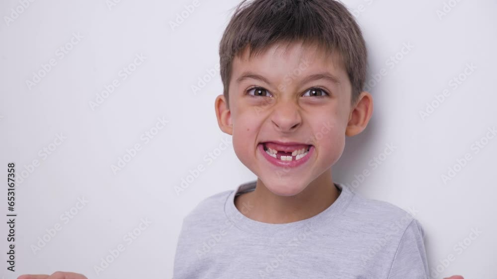 Close-up mouth child has lost one milk teeth. Replacement of permanent ...