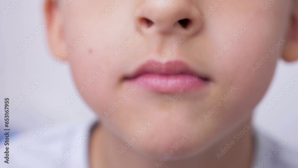 Close-up mouth child has lost one milk teeth. Replacement of permanent ...