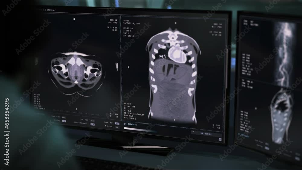 Medical exam procedure scanning the body of the sick patient at the ...