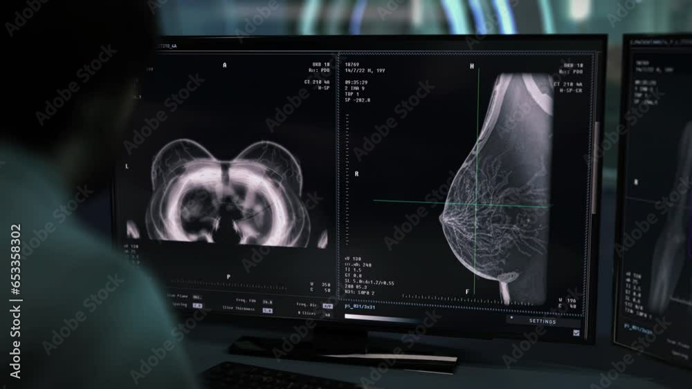 Medical test procedure with a mammography scanner at the modern ...