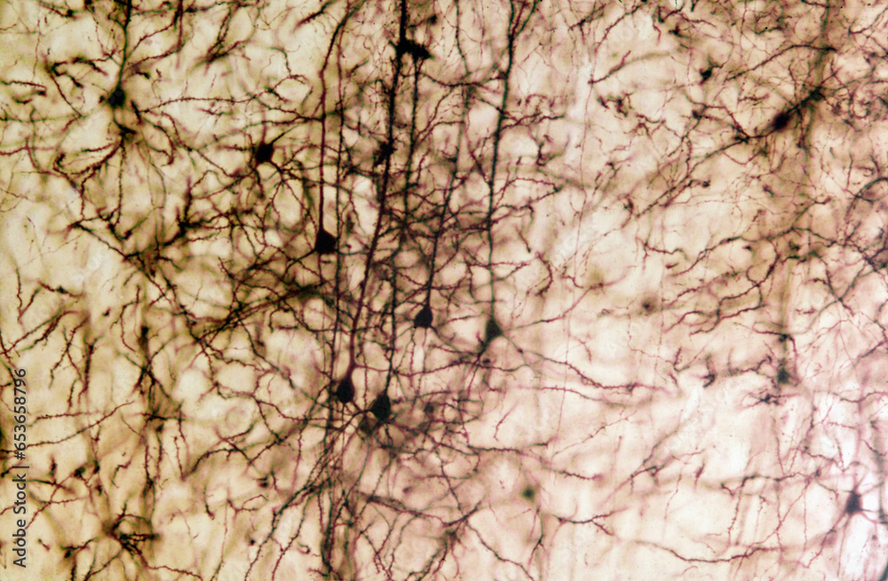 Poster Cerebral cortex. Pyramidal neurons – Wall Art | UkPosters