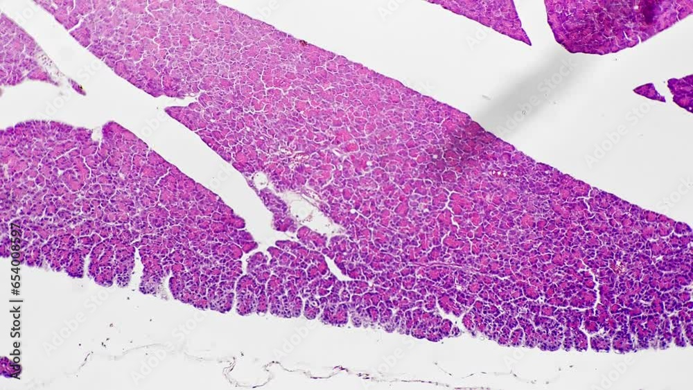Human pancreas tissue in section filmed and magnified under microscope ...
