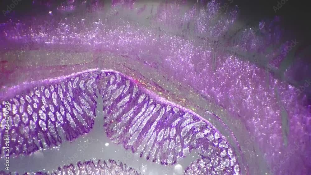 Piece of human rectum filmed with magnification 100x and cross light ...