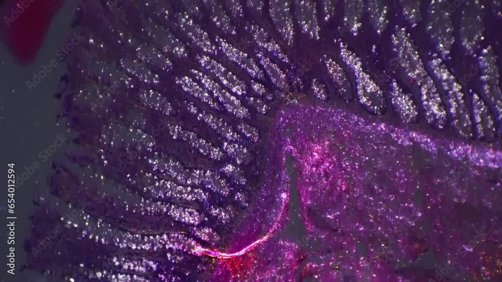 Piece of human rectum filmed with magnification 400x and cross light ...