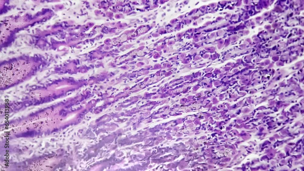 Macro footage of human stomach in section studied in lab under ...