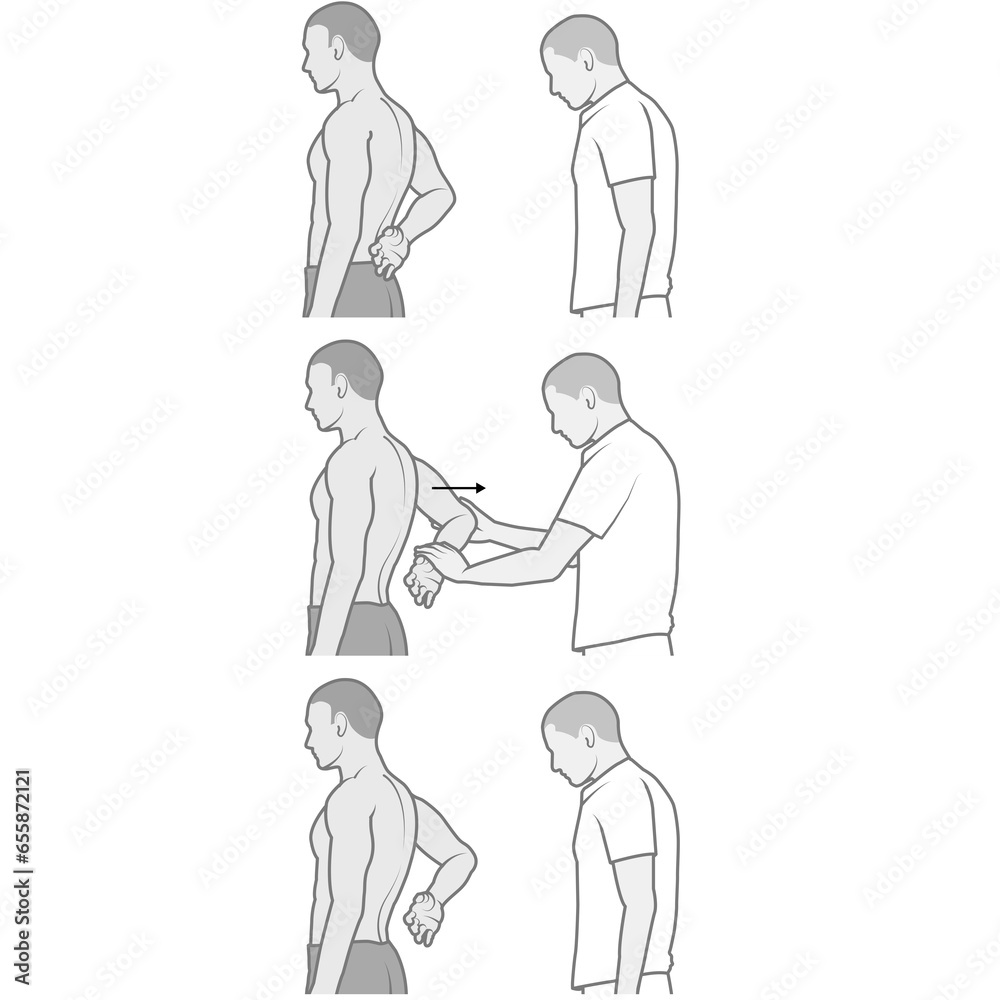 Shoulder Examination. Lift-off Sign Test. Illustration Is Part Of ...