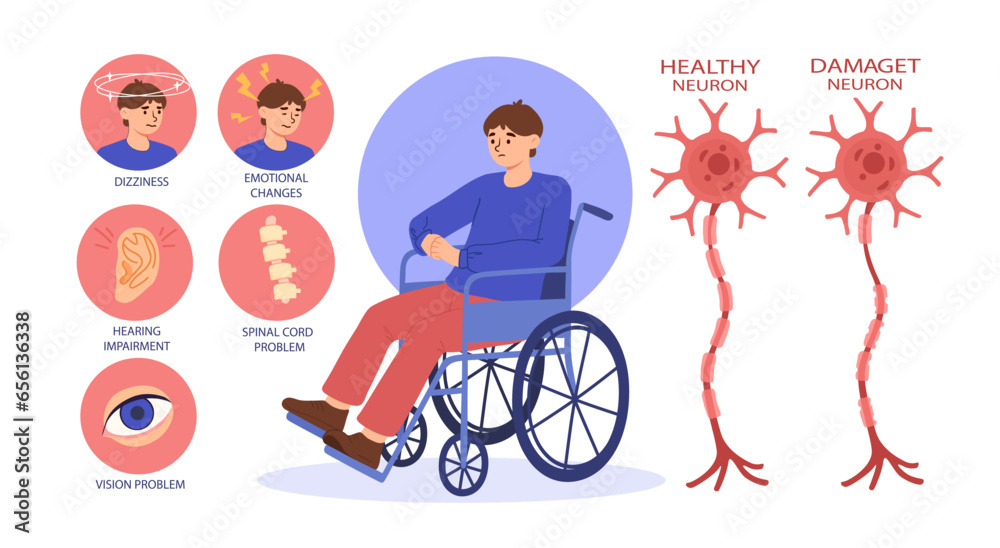 Damaged neuron concept. Medical infographics and educational materials ...