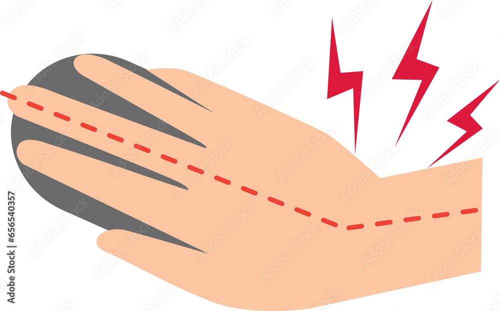 Wrong And Right Ways For Hand Position In Use Keyboard And Mouse Stock