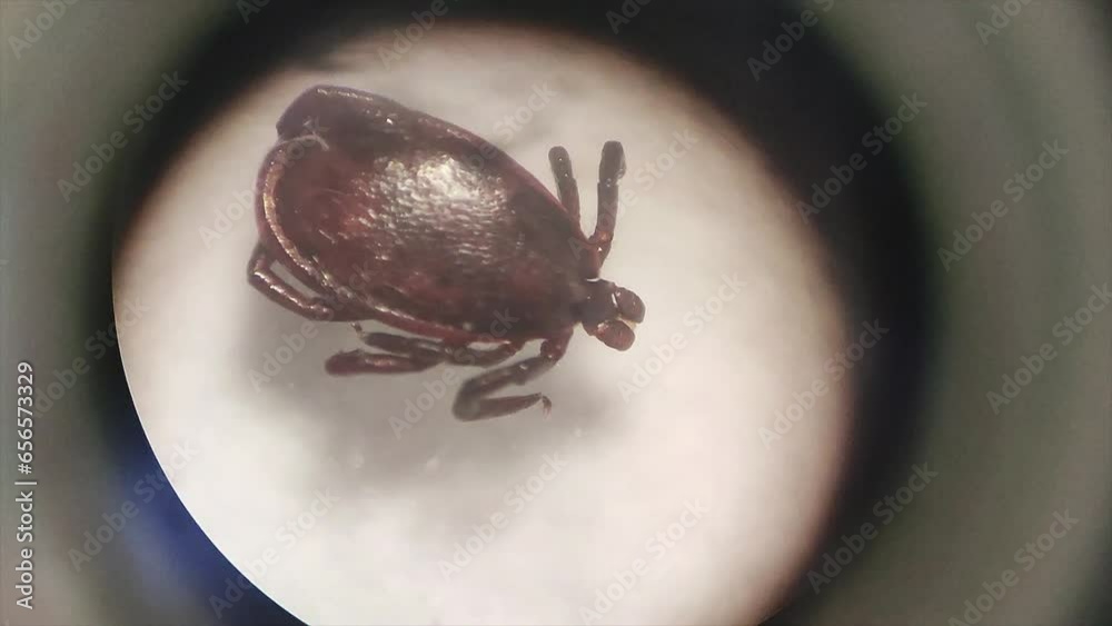 Acari mite under microscope. Ixodes tick. Tick-borne disease Stock ビデオ ...