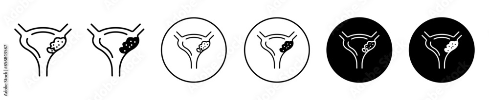 Bladder cancer icon. overactive human bladder causing problem in ...