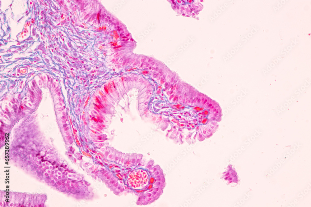 Histological Rectum human, Gall bladder human and Urethra Human under ...