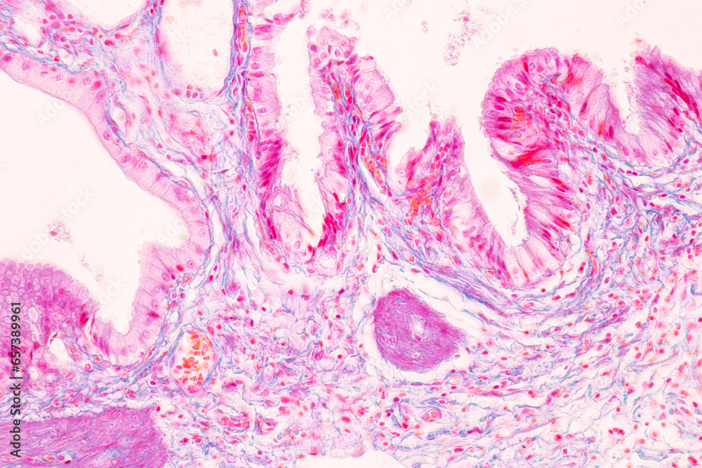 Histological Rectum human, Gall bladder human and Urethra Human under ...