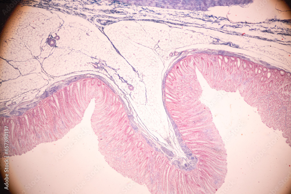 Histological Rectum human, Gall bladder human and Urethra Human under ...