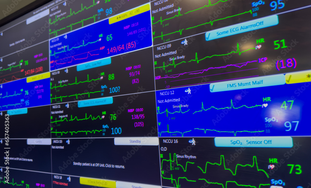 Medical monitor displays vital signs with graphs and numbers, heart ...