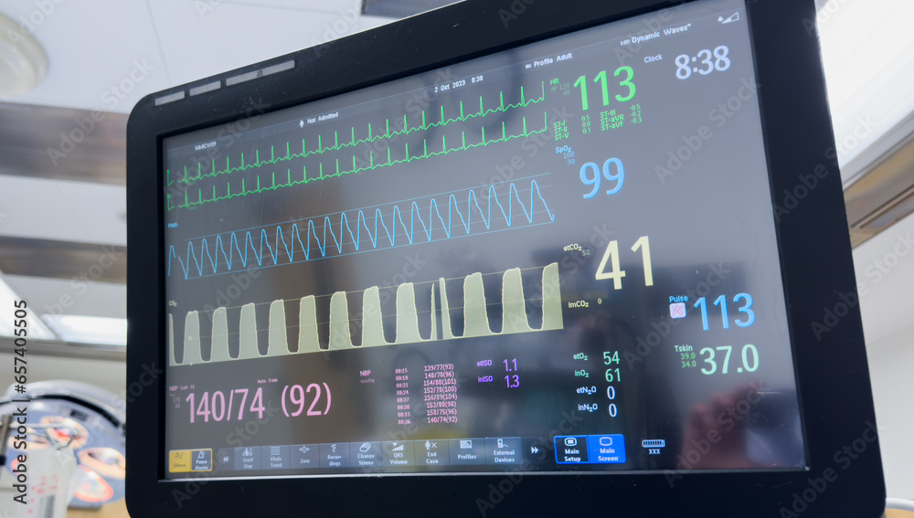 Medical monitor displays vital signs with graphs and numbers, heart ...