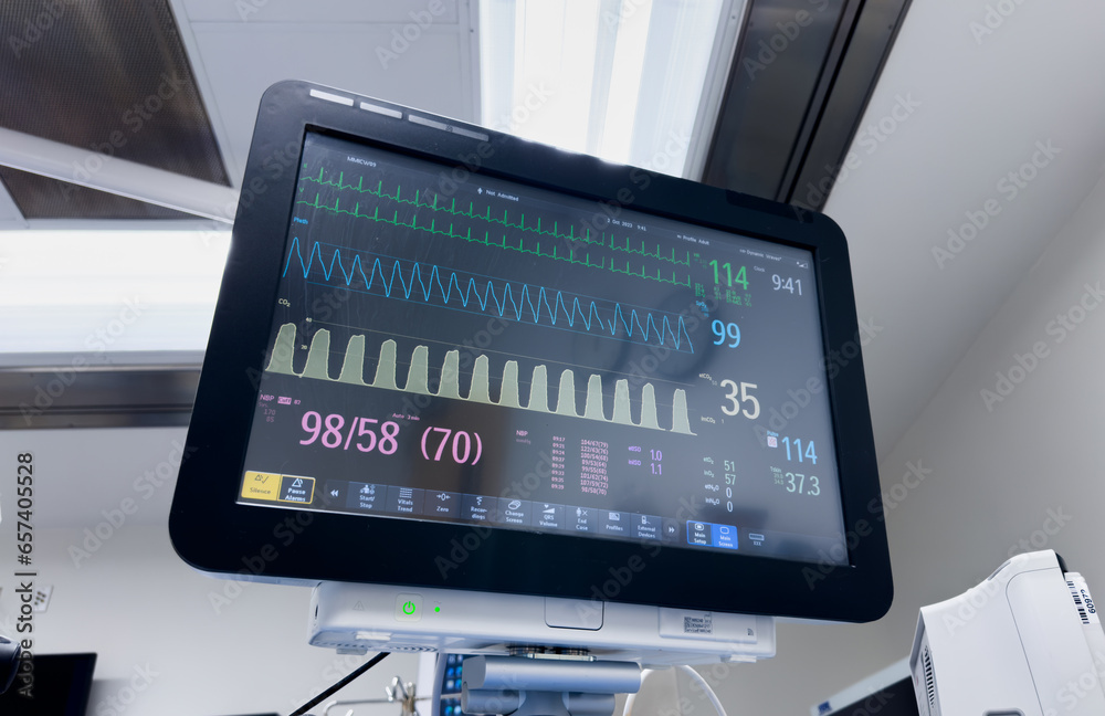 Medical monitor displays vital signs with graphs and numbers, heart ...