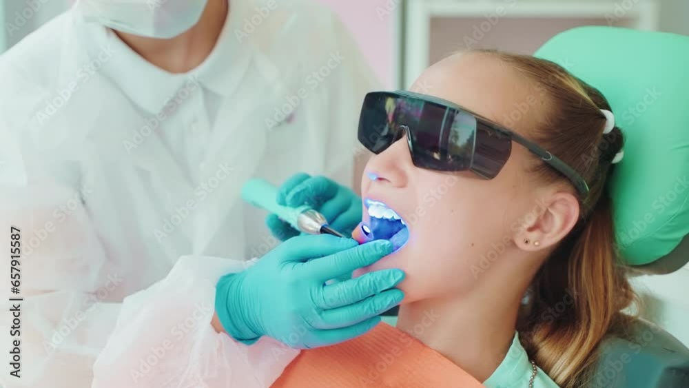 Dentist installs light-curing seal in dentistry to patient teen girl ...