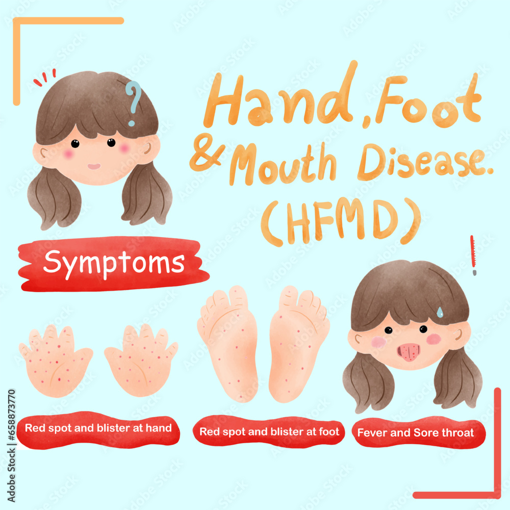 The hand-foot-mouth disease infographic for primary school health care ...