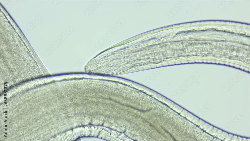 worm Nematoda under microscope, Phylum Protostomia, free-living ...