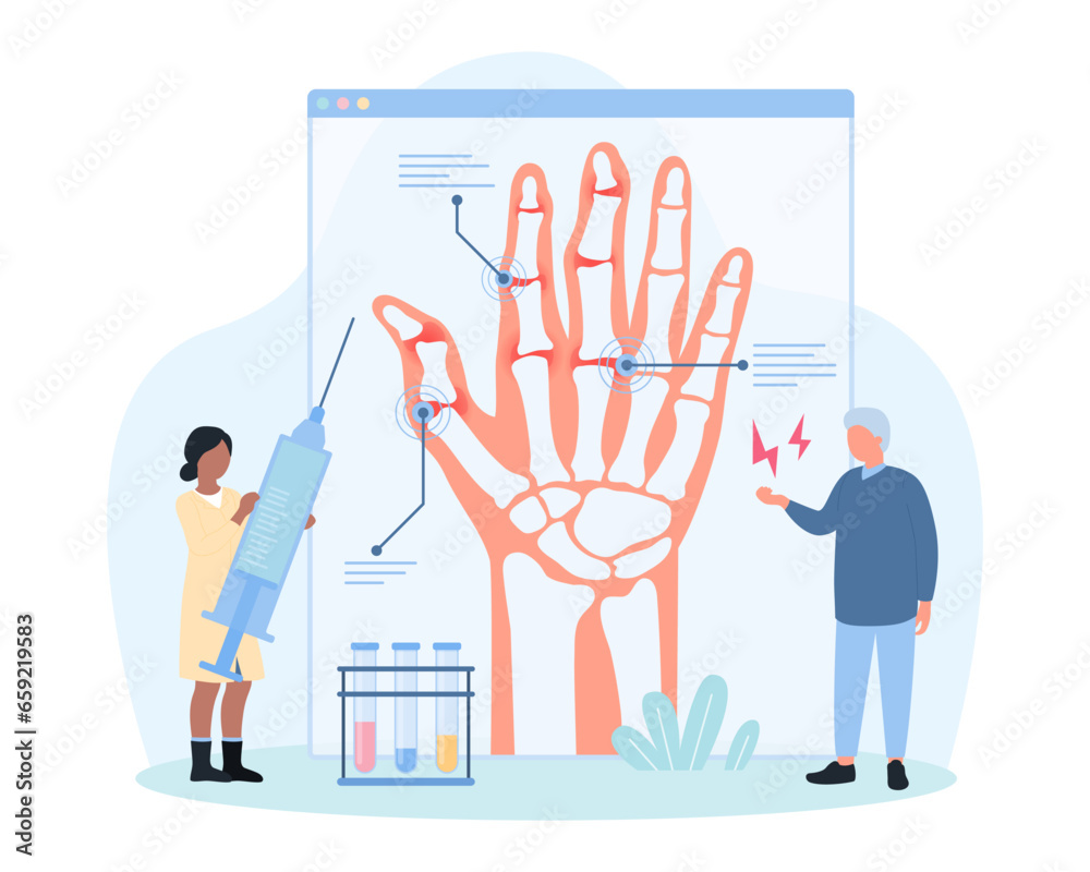Diagnosis and treatment of arthritis vector illustration. Cartoon tiny ...