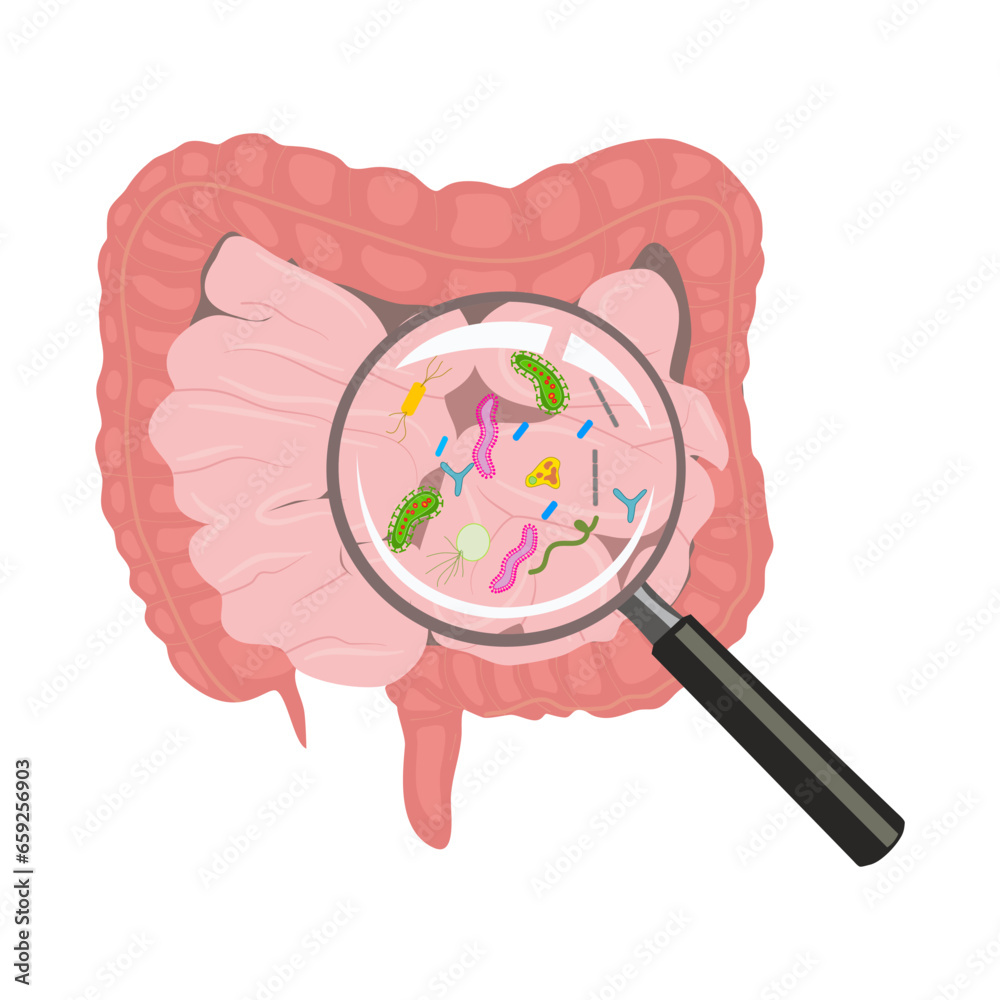 Poster Small intestinal bacterial overgrowth (SIBO) is defined as the ...