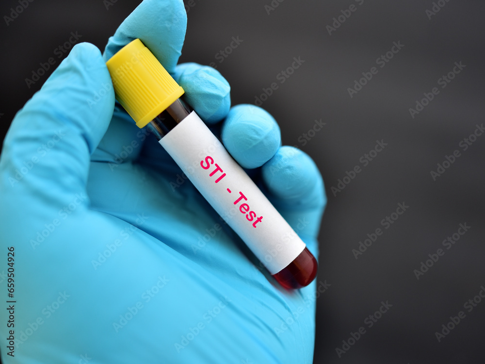 Blood sample for sexually transmitted infection (STI) test Stock Photo ...