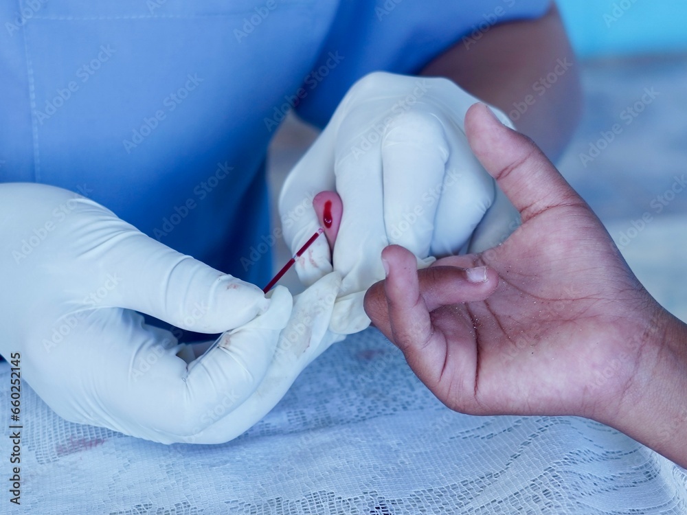 HCT , Hematocrit centrifuge plate with capillary tube , Hematocrit ...