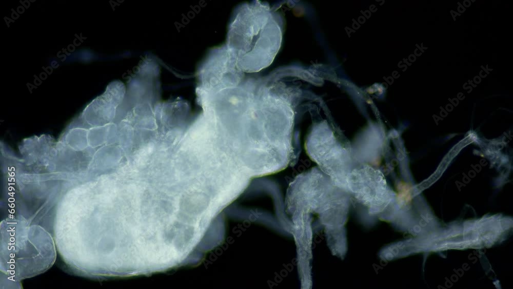 Larvae of parasitic worm Progonus muelleri under a microscope, at ...