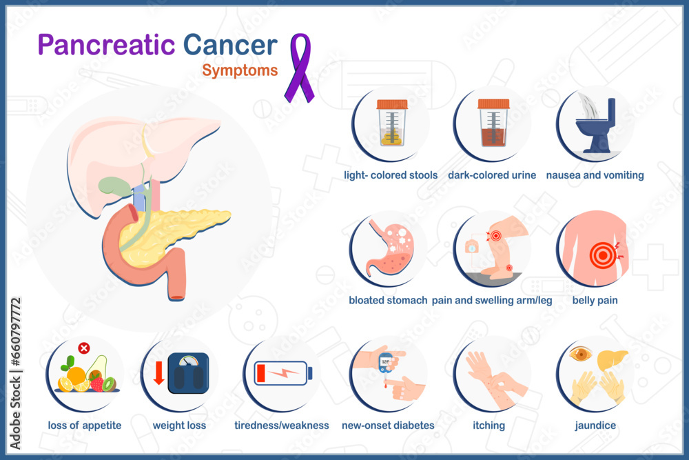 Vector medical illustration in pancreatic cancer concept. Symptoms of ...