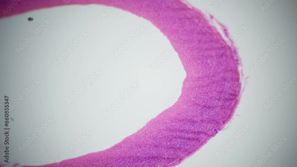 Stockvideon Human artery specimen. HQ video under microscope with 100x ...