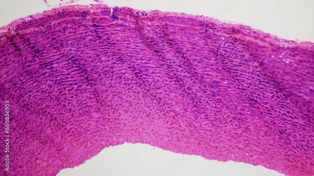 Human artery specimen. HQ video under microscope with 100x ...
