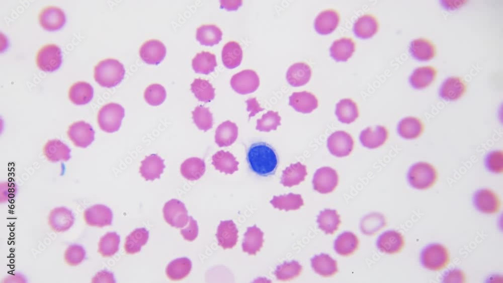 RBC and WBC under microscope. HQ video. Science class. Inspection of ...