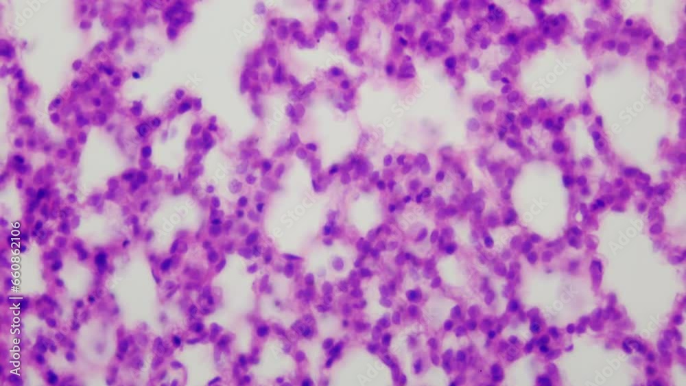 The process of gas exchange in the human lungs. Light tissue section ...