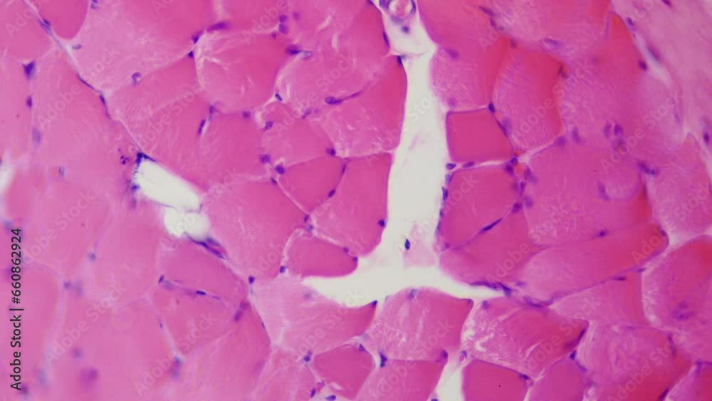 Human skeletal muscle under a microscope. Cross section of the sample ...