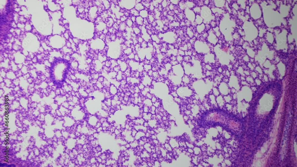 Thinnest section of a human lung under a microscope. Bright-field ...