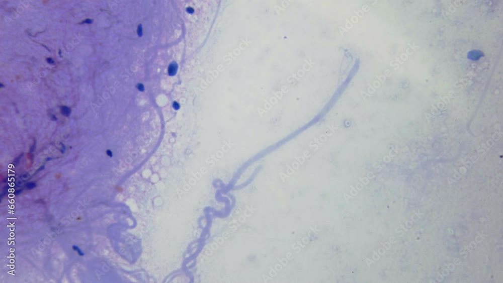 Motor neuron under a microscope. Study of motor activity in the human ...