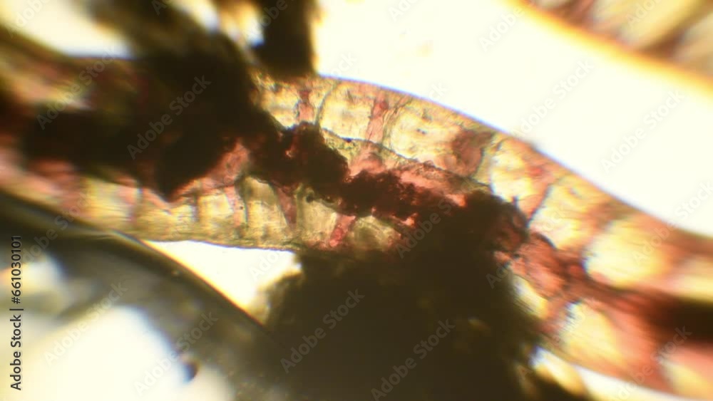 intestine of nematode under the microscope, 150x magnification Stock ...