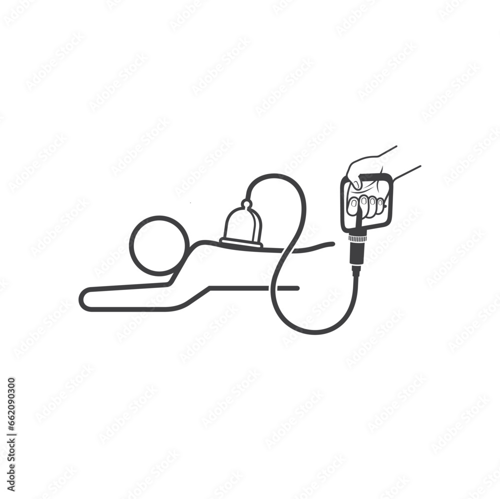illustration of hijama or cupping therapy Icons in flat vector art ...