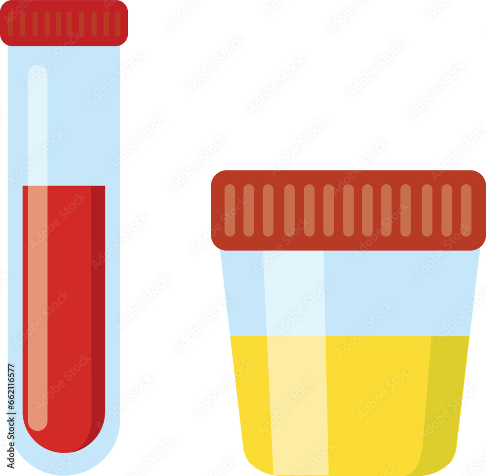 Test tube with blood and urine sample container isolated on white ...