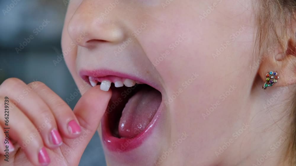 The child shakes the front baby tooth and smiles a toothless smile ...