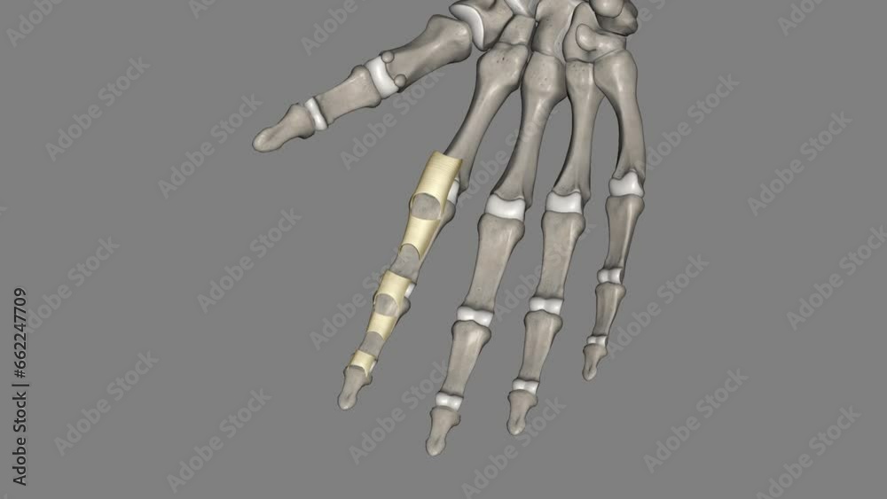 The annular ligament is a complex structure formed from the capsule ...