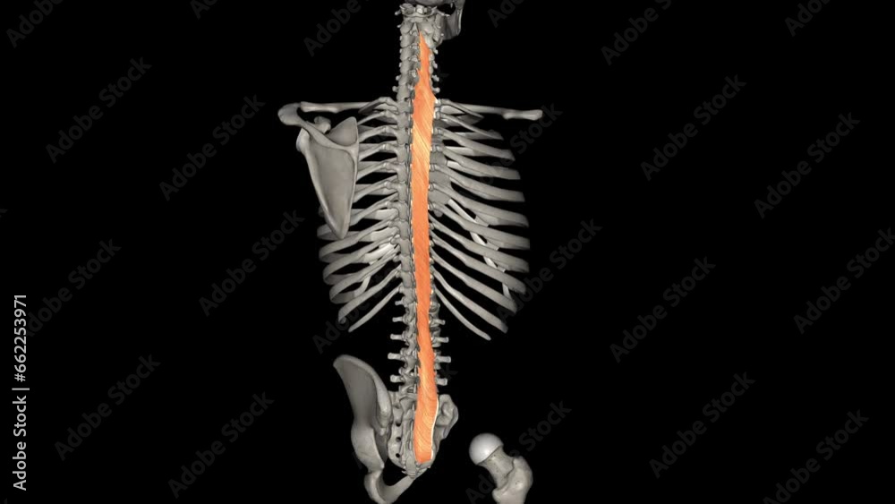 The multifidus muscle is an important stabilizer of the lumbar spine ...