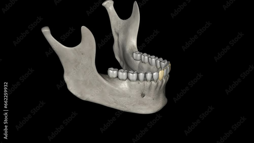 The mandibular lateral incisor is the tooth located distally from both ...