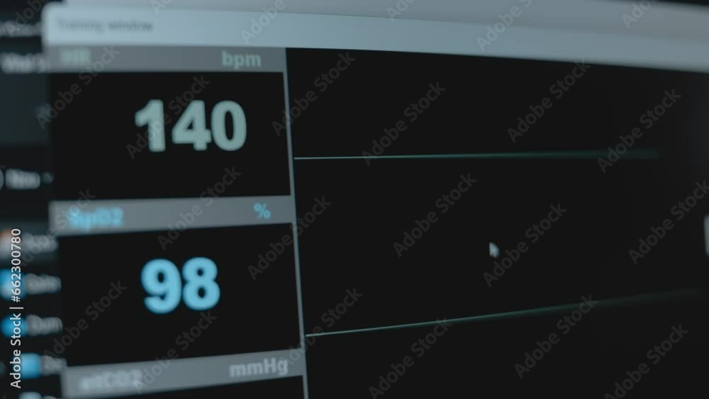 Close-up view of the screen of patient monitor displays vital signs ECG ...