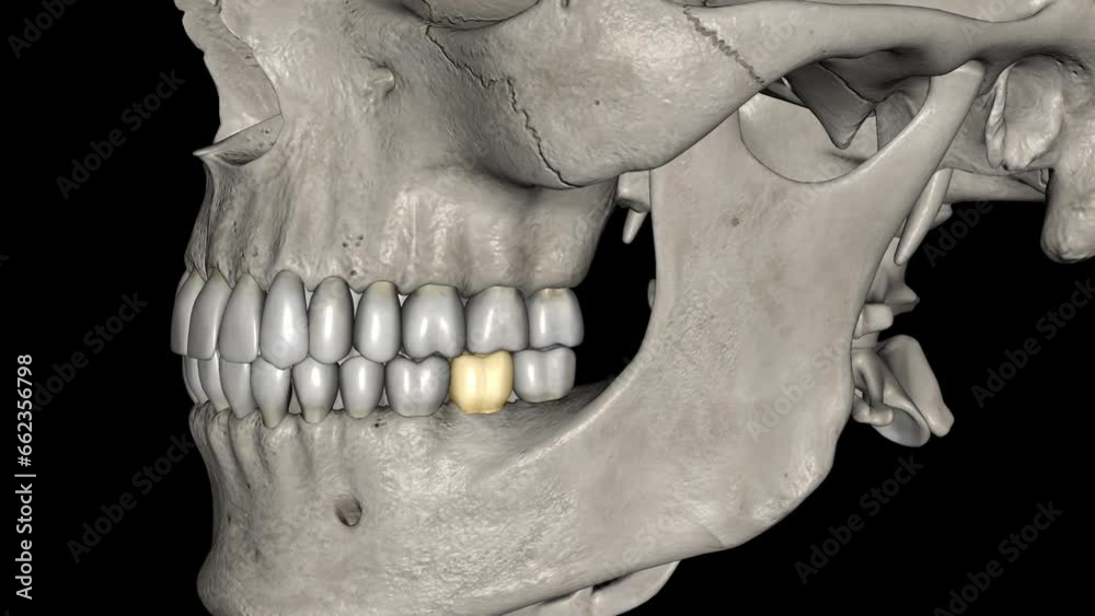 The mandibular second molar is the tooth located distally from both the ...