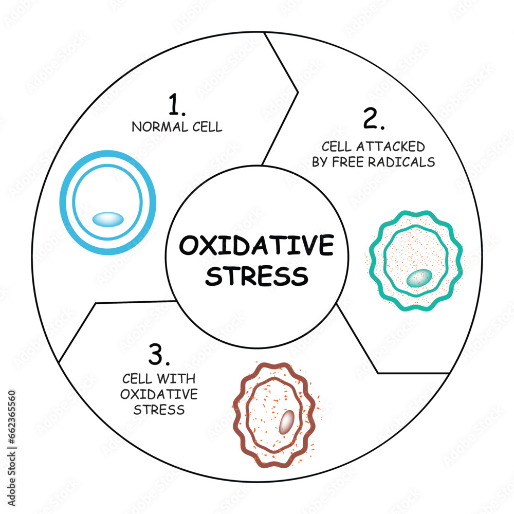 Oxidative Stress, free radicals and antioxidants, Normal Cell, Cell ...