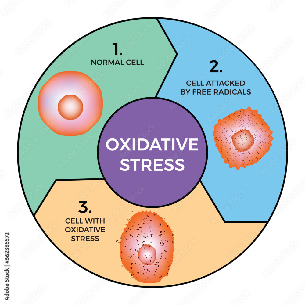 Oxidative Stress, Normal Cell, Cell Attacked by Free Radicals, Cell ...